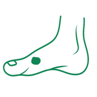 Diabetische Voet | Spronken Orthopedie